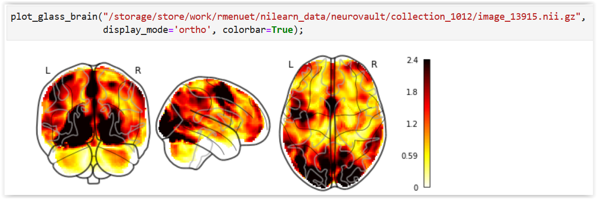 plot_glass_brain with 4 cuts displays the colorbar on the 4th view · Issue #1779 · nilearn ...