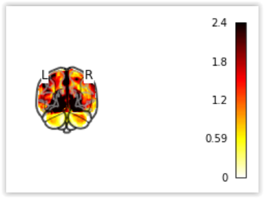 plot_glass_brain with 4 cuts displays the colorbar on the 4th view ...