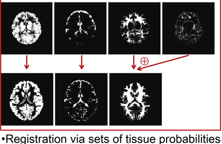 How to register two image using tissue probability map? · Issue #743 · ANTsX/ANTs · GitHub