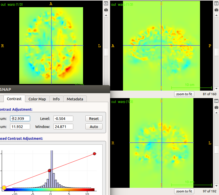 Question about train on custom dataset and fixed image · Issue #93 · voxelmorph/voxelmorph · GitHub