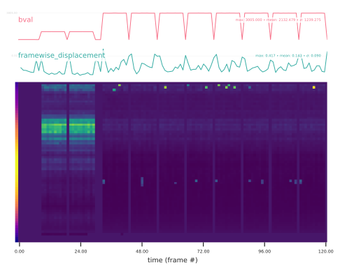 Multishell-data BIDS-structure · Issue #320 · PennLINC/qsiprep · GitHub