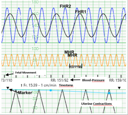 Live streaming Chart · Issue #2373 · Megabit/Blazorise · GitHub