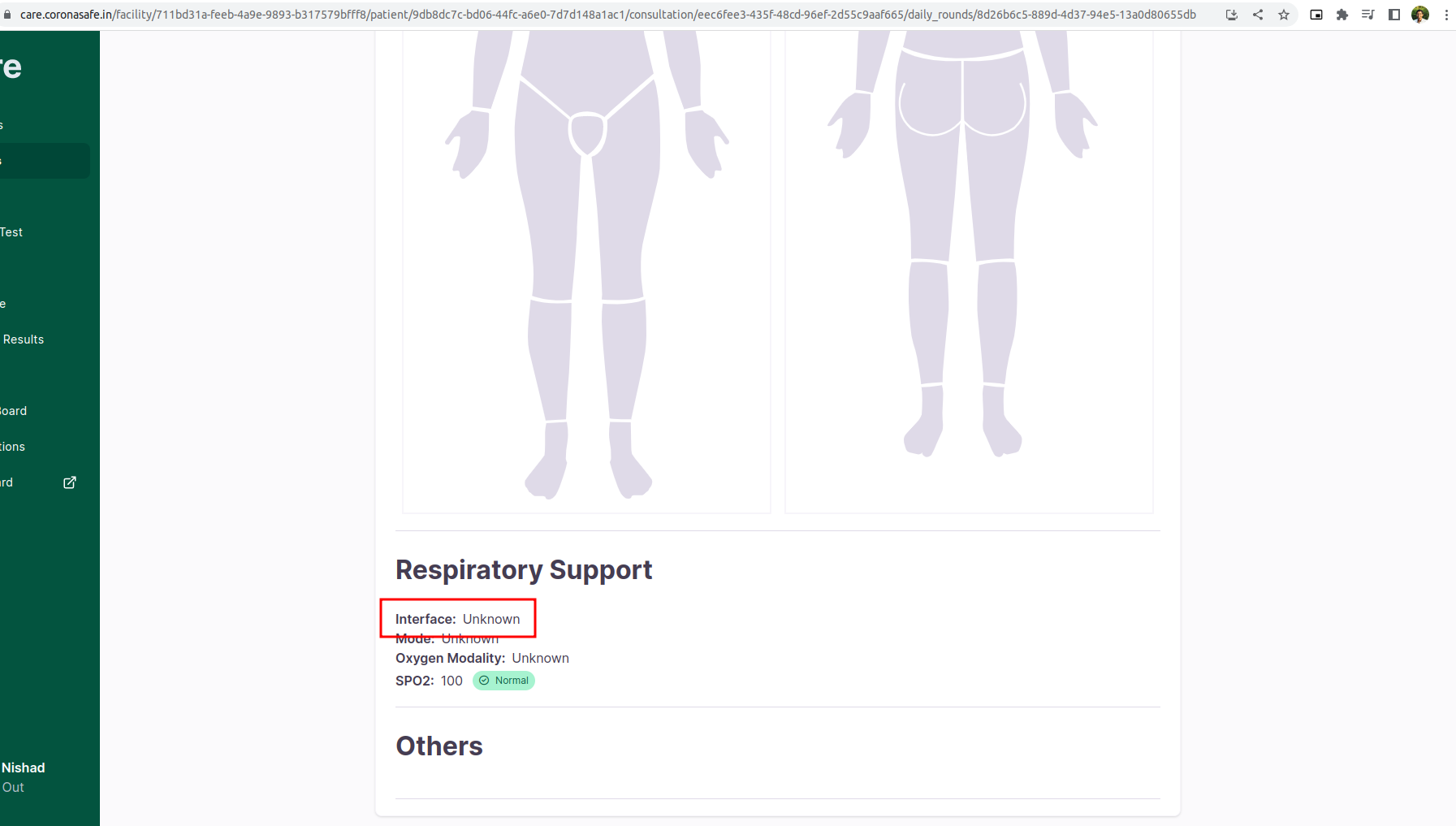 Rename "Unknown" to "None" for Interface in Respiratory Support section view details of log ...