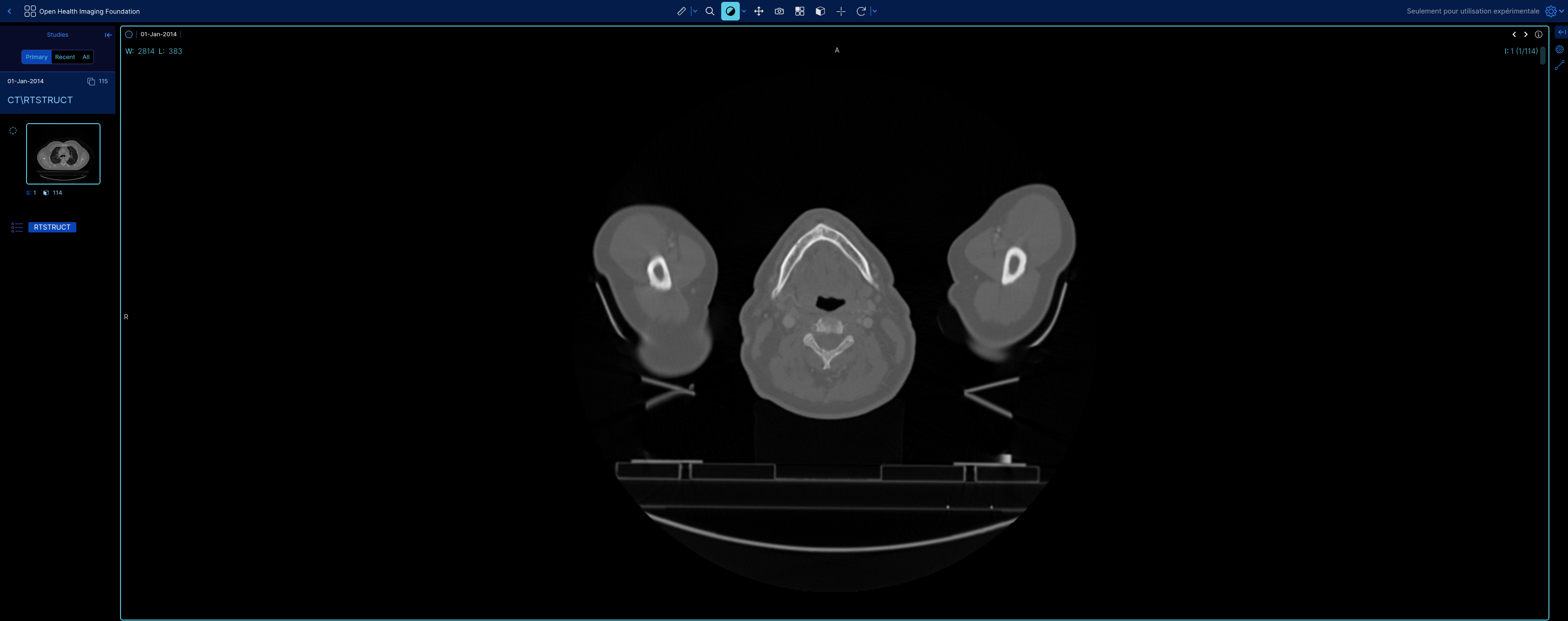 Feature Request Display Patient Name · Issue 3769 · Ohifviewers · Github