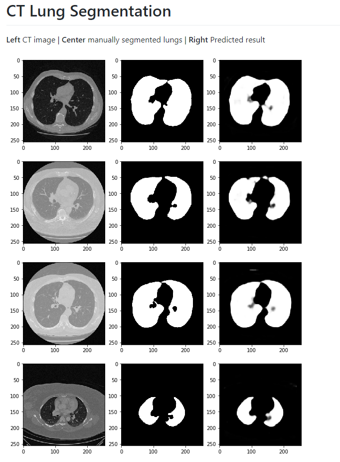 GitHub - jaewoocho/Deep-learning-CT-Lung-Segmentation-Replica