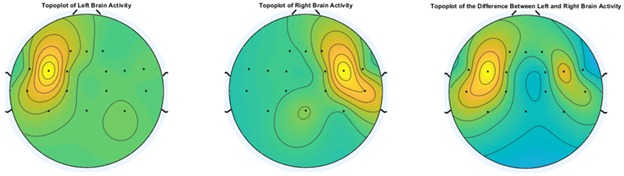 GitHub - jm4302/EEG-CSP-Filter-Project