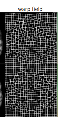 Warp_Field · Issue #116 · voxelmorph/voxelmorph · GitHub