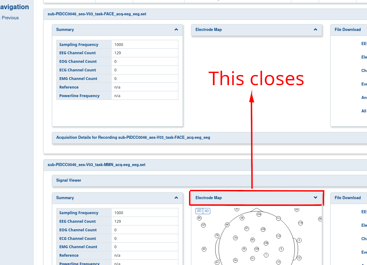 [electrophysiology_browser] only the first collapsible blocs actually collapse · Issue #8208 ...