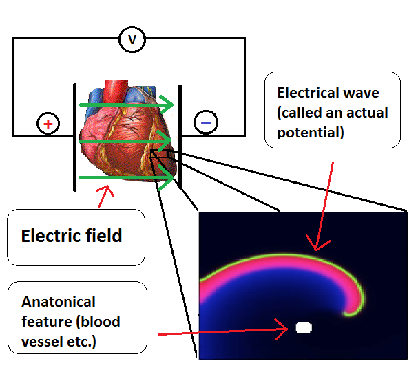 GitHub - MikiHan12/NewDefibrillationMechanism: Mechanism of Vortices ...