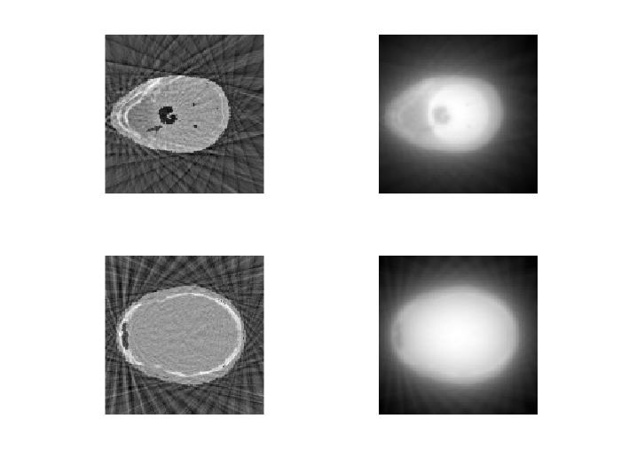 FISTA on Multi-GPU · Issue #190 · CERN/TIGRE · GitHub