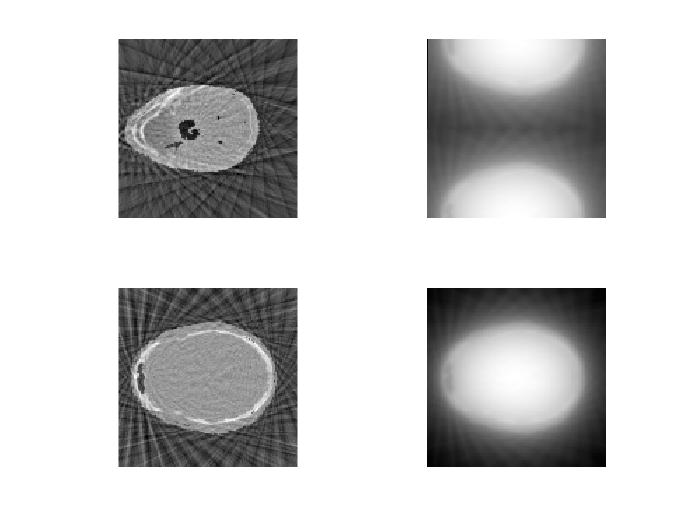 FISTA on Multi-GPU · Issue #190 · CERN/TIGRE · GitHub