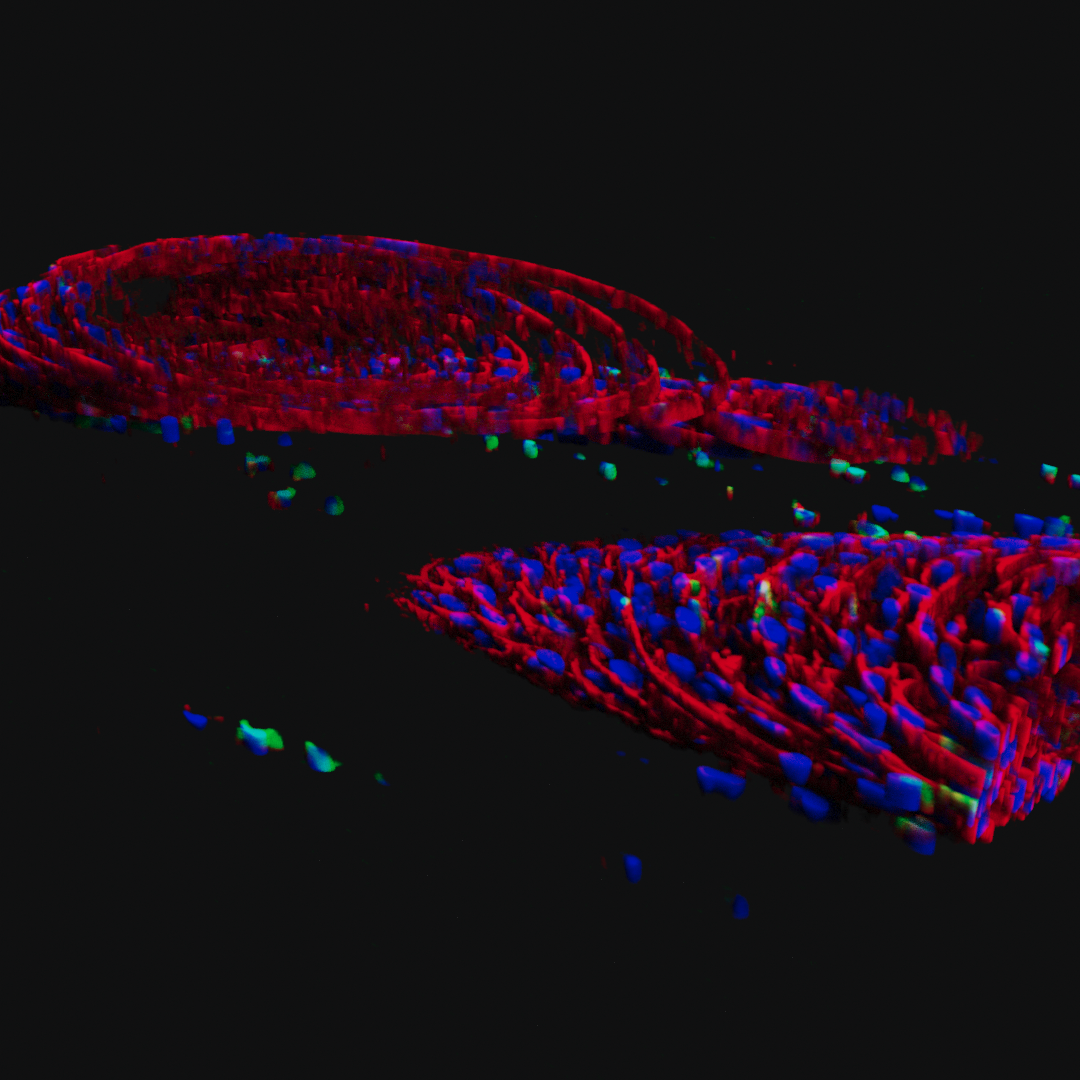 Stack 2D Tiff Images to 3D Model for Volumetric Rendering · Issue #19 · tkeskita/BVtkNodes · GitHub