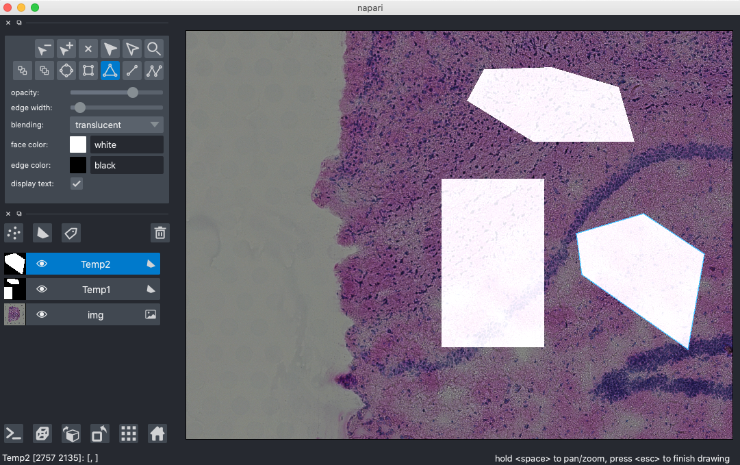Napari for visualizing images · Issue #89 · scverse/squidpy · GitHub