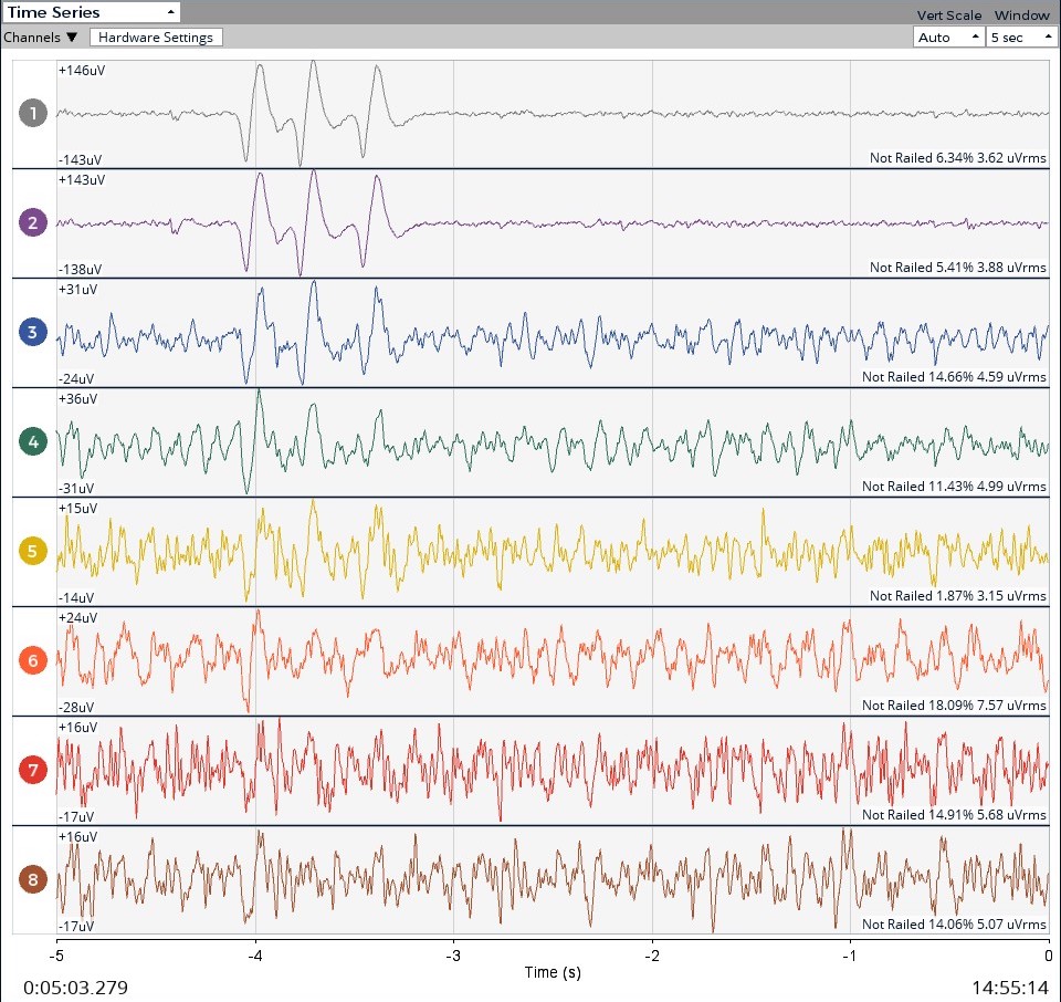 Update GUI TImeSeries Screenshot in GUI Widget Guide · Issue #87 · OpenBCI/Documentation · GitHub
