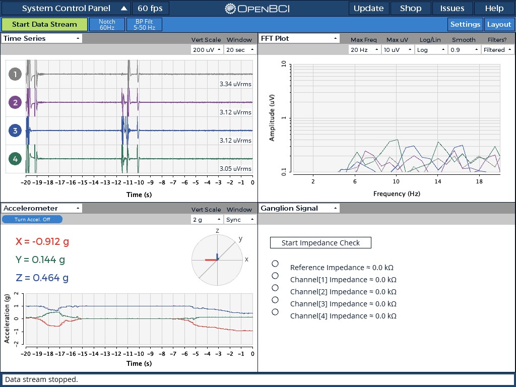 Sync horizontal scale of Time Series and Accelerometer widgets · Issue #410 · OpenBCI/OpenBCI ...