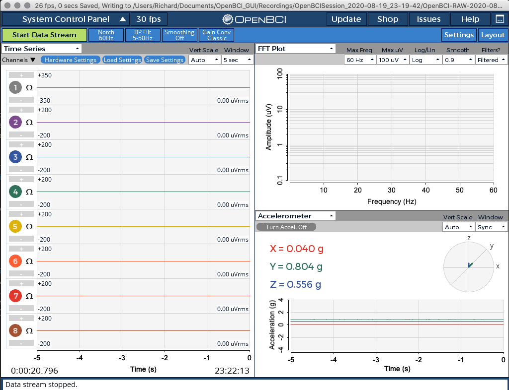 Set vertical scale per channel by retiutut · Pull Request #852 · OpenBCI/OpenBCI_GUI · GitHub