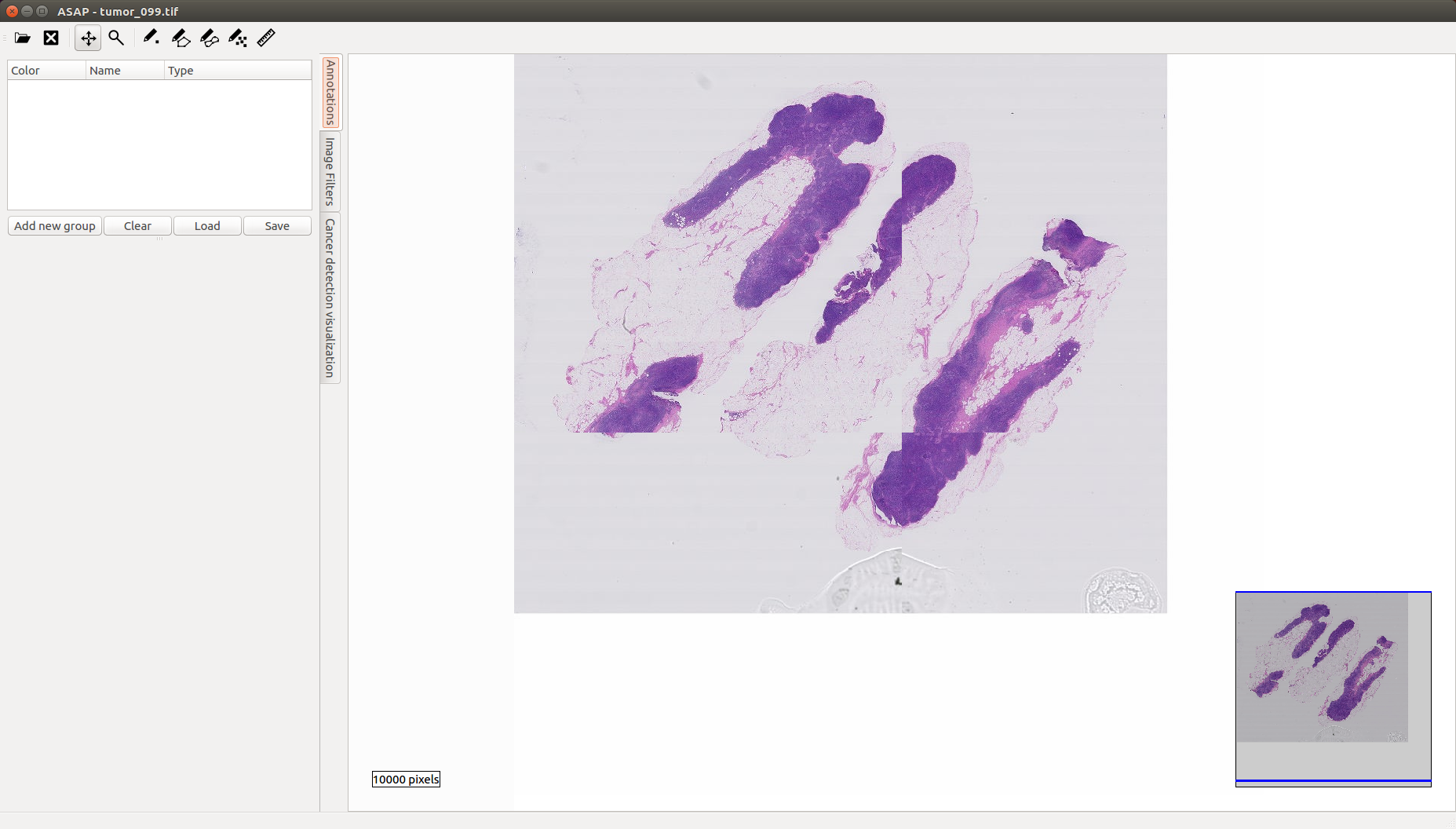 ASAP 1.7.3 linux version not working correctly · Issue #63 · computationalpathologygroup/ASAP ...