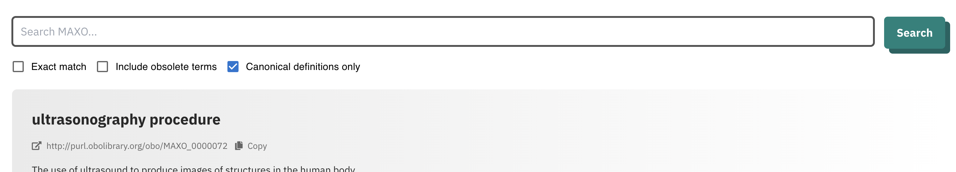 Search bar within ontology does not search in ontology · Issue #302 · EBISPOT/ols4 · GitHub