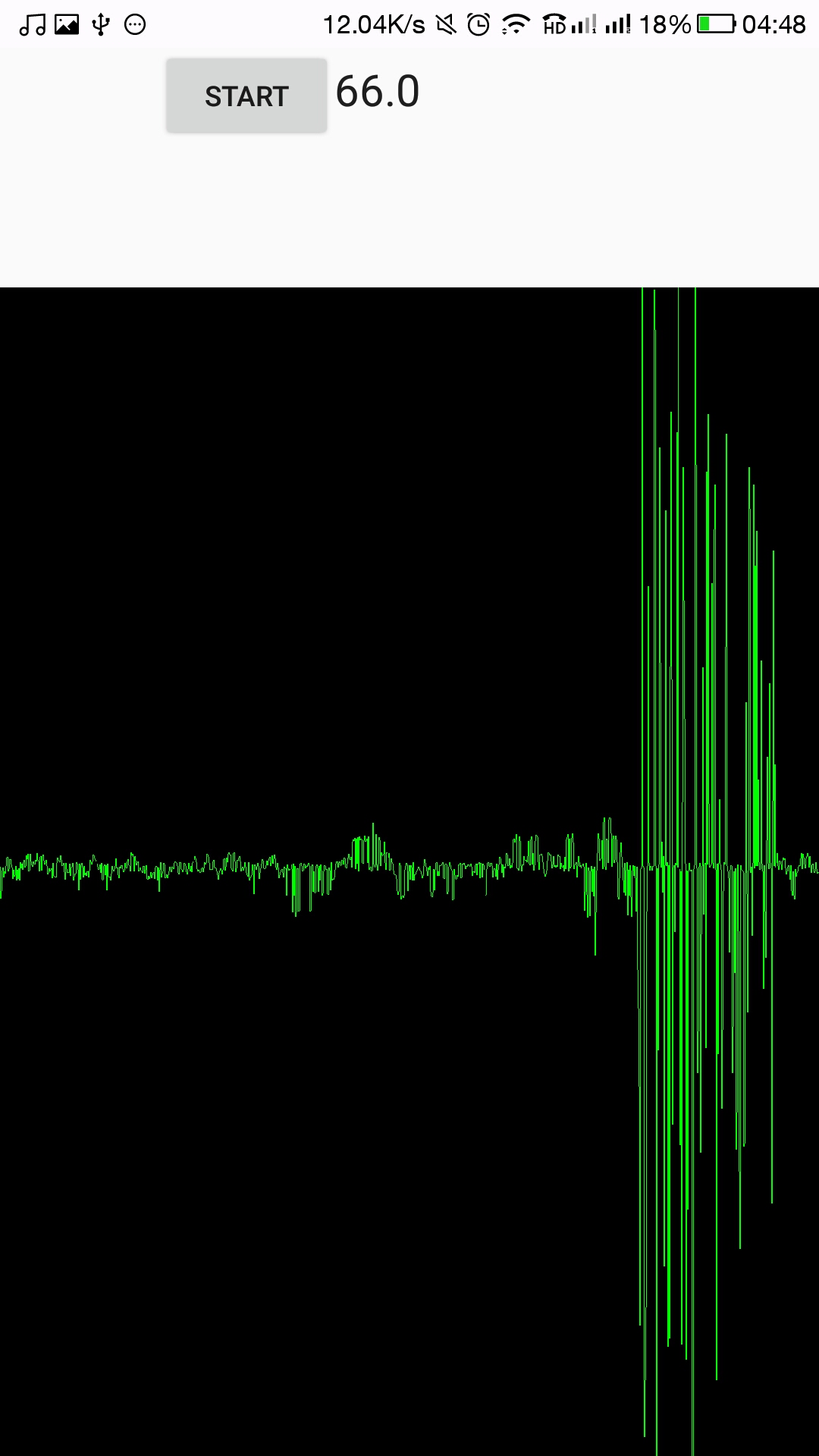 Github Jit0434 Snoring Detection