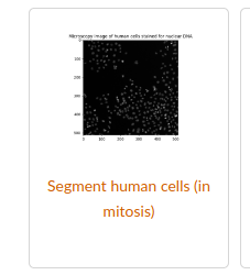 Add first biology example: segmentation of human cells with mitosis. by ...