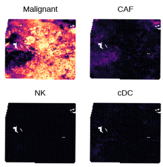 Question : celltype per spot · Issue #9 · data2intelligence/SpaCET · GitHub