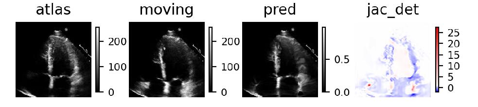 Hyperparameters about training SYMNet on 2D data. · Issue #9 · cwmok/Fast-Symmetric ...