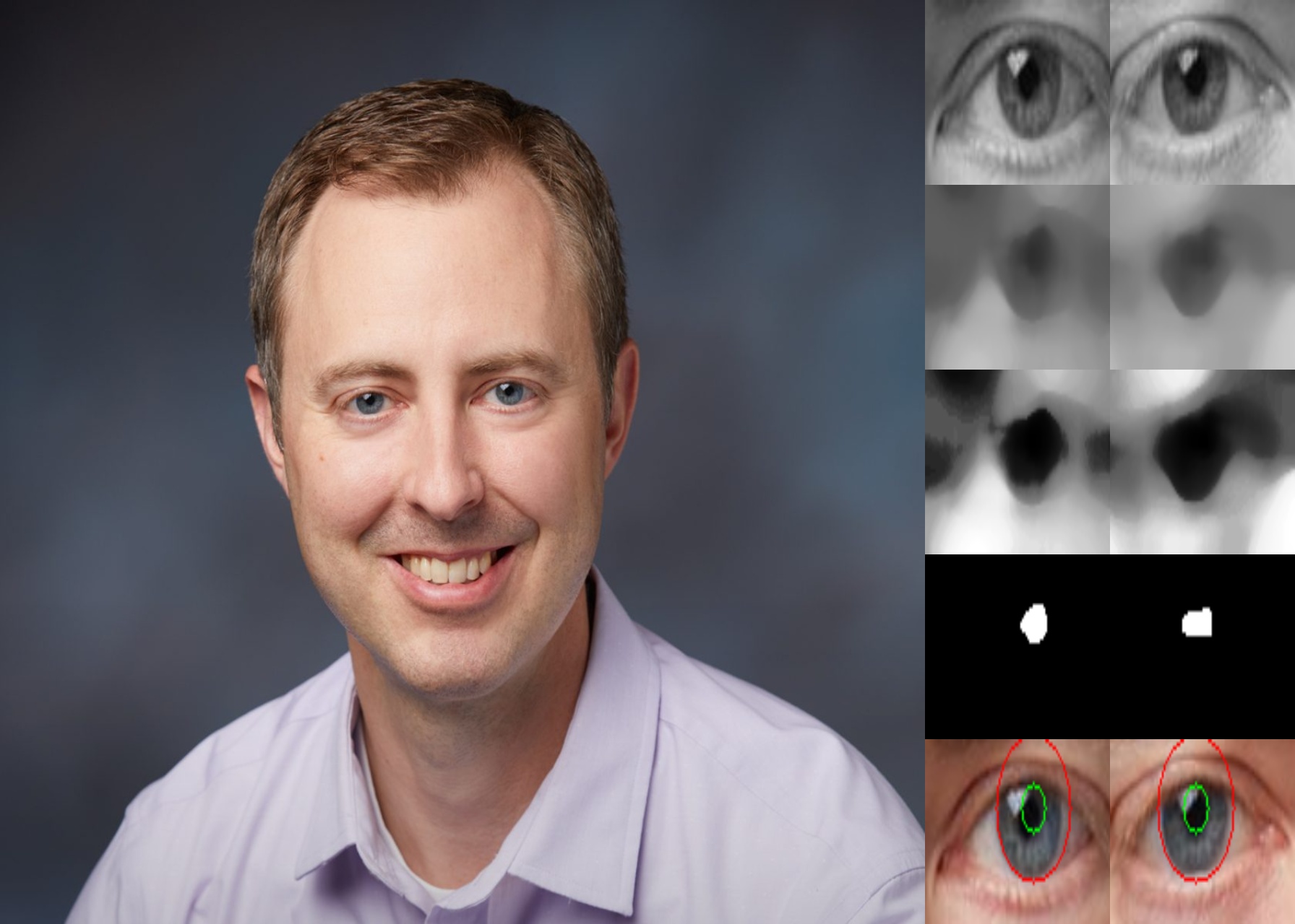 GitHub - anmolduainter/Pupil-Dilation