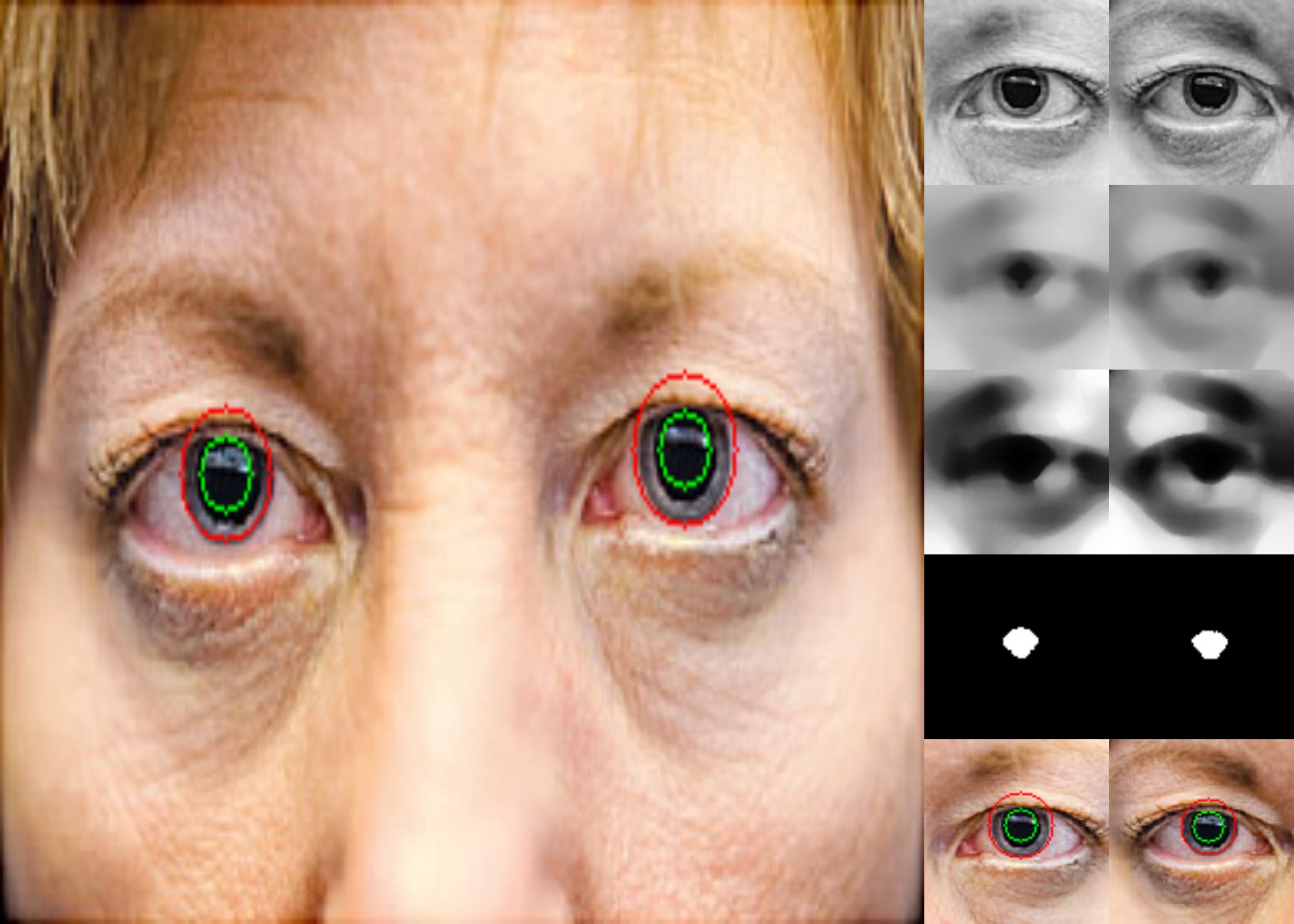 GitHub - anmolduainter/Pupil-Dilation