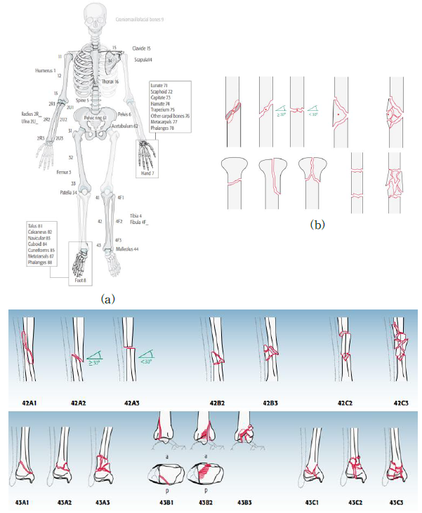 GitHub - CBNU-AILAB/fracture