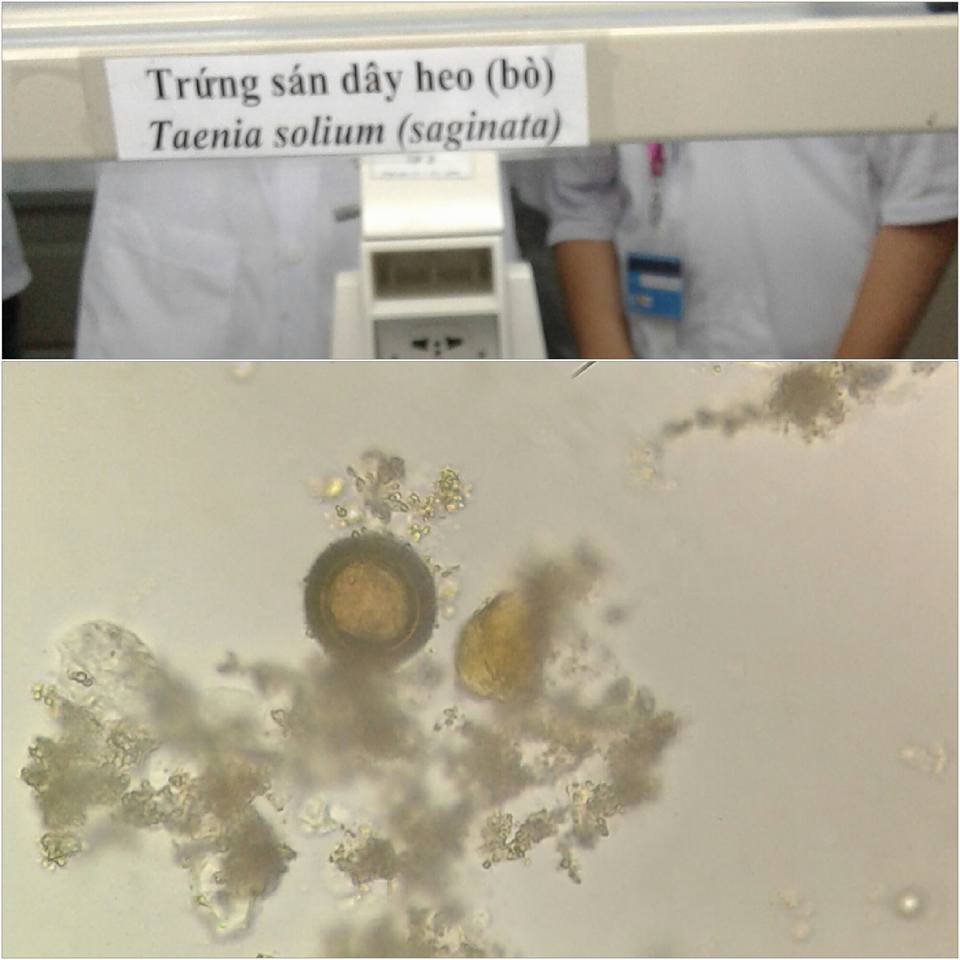 Unsupported image in file jpg · Issue #158 · glutanimate/image-occlusion-enhanced · GitHub