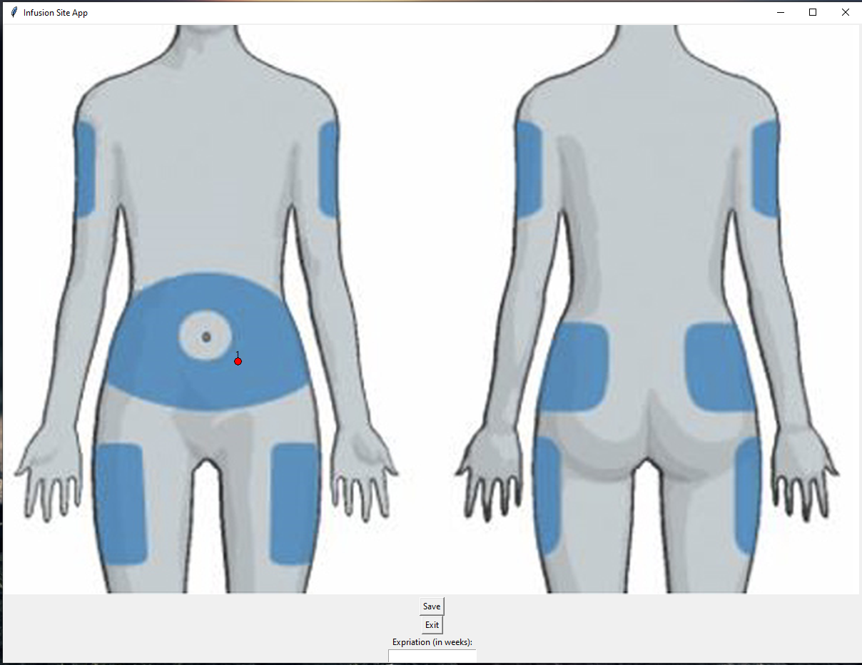 GitHub - chirokun/Infusion-Site-Tracking-App: Application for tracking infusion site placement.