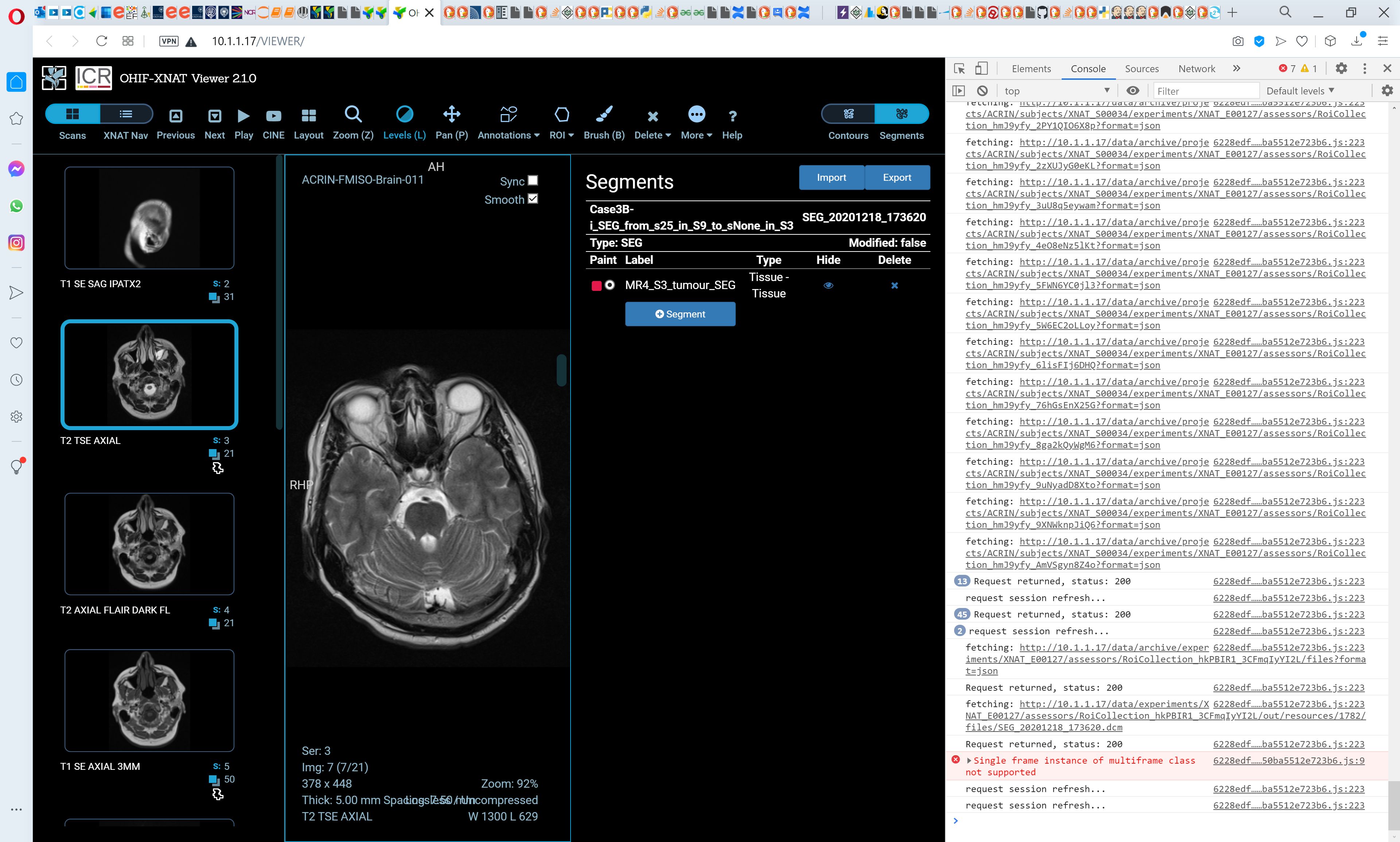 Segmentations not rendered in OHIF-Viewer · Issue #2212 · OHIF/Viewers · GitHub