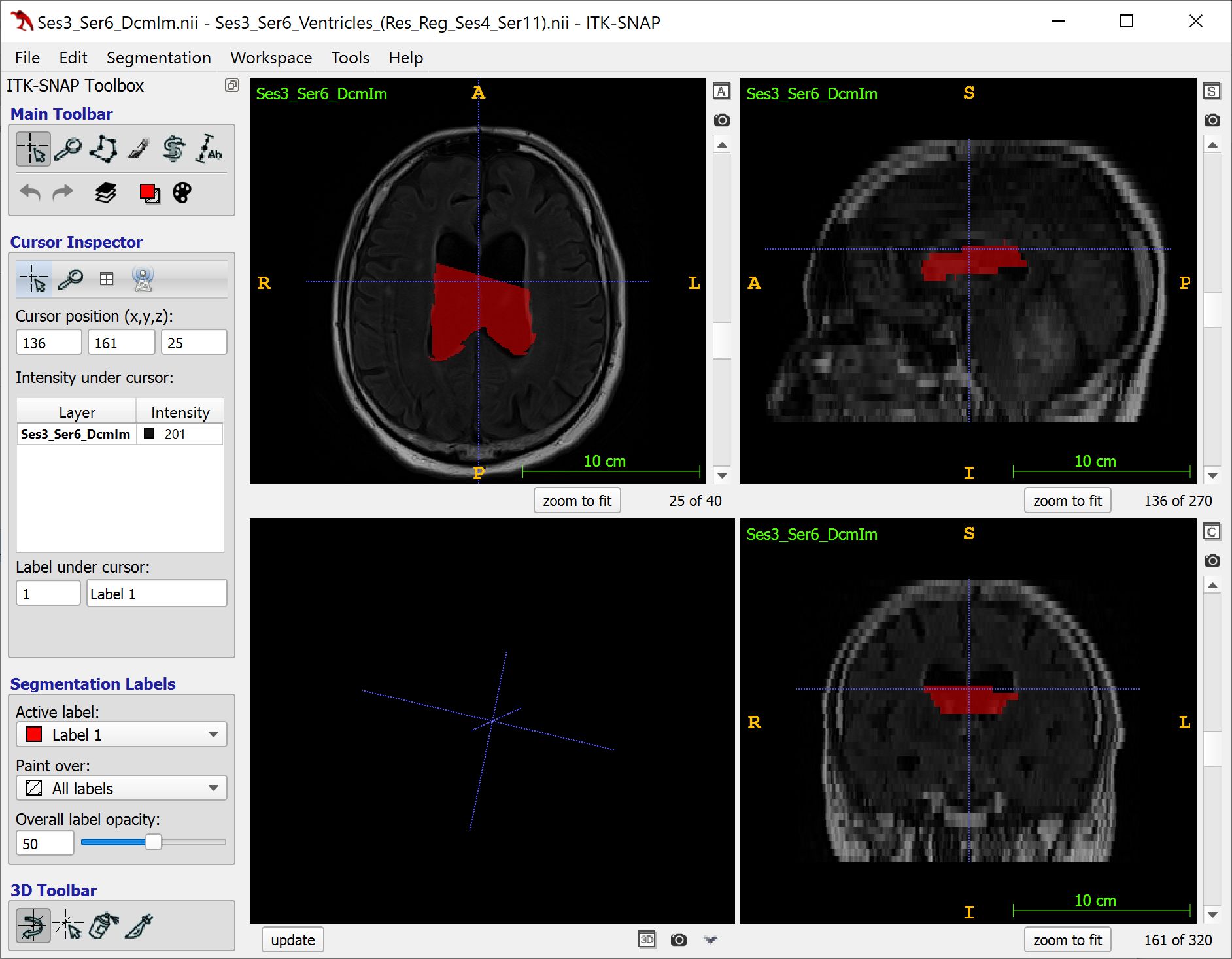 Resampled image is cropped · Issue #1358 · SimpleITK/SimpleITK · GitHub