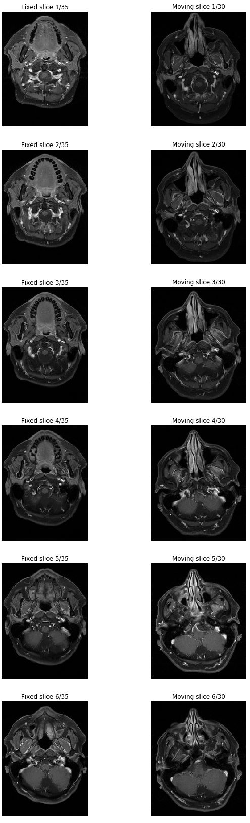 DICOM stack not read in order and unable to cast from numpy to ants ...