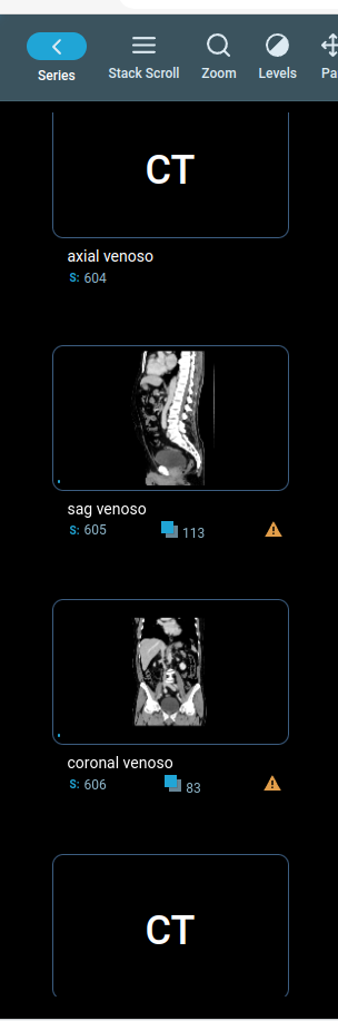 When a request fail all the series fail · Issue #2744 · OHIF/Viewers · GitHub