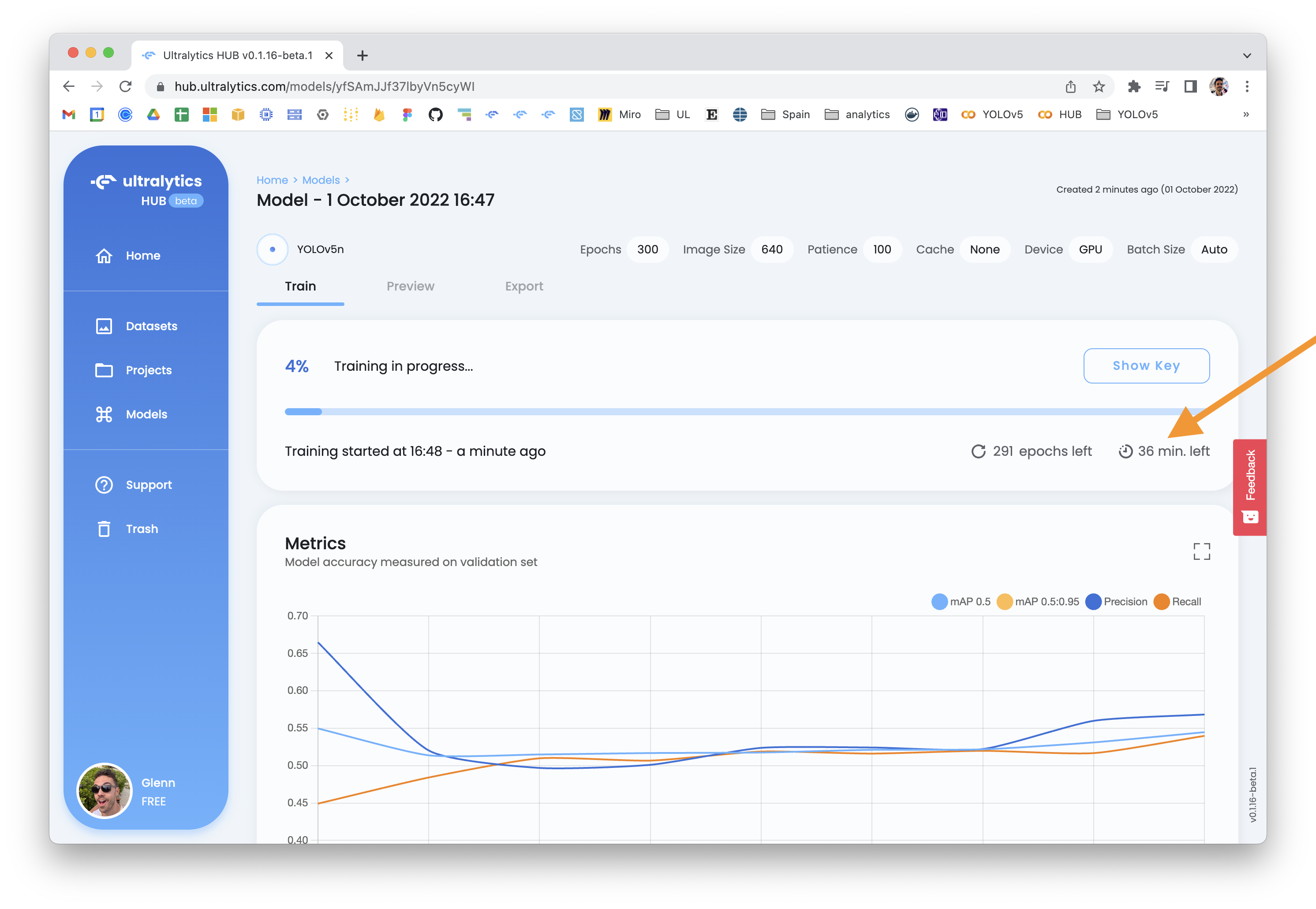 Epoch status messages · Issue #9659 · ultralytics/yolov5 · GitHub
