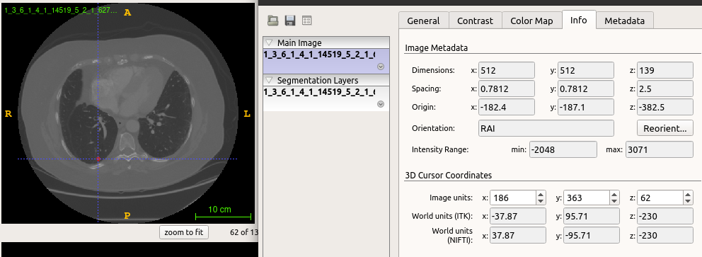 detection: conversion between monai box and nndetection box · Issue #1225 · Project-MONAI ...