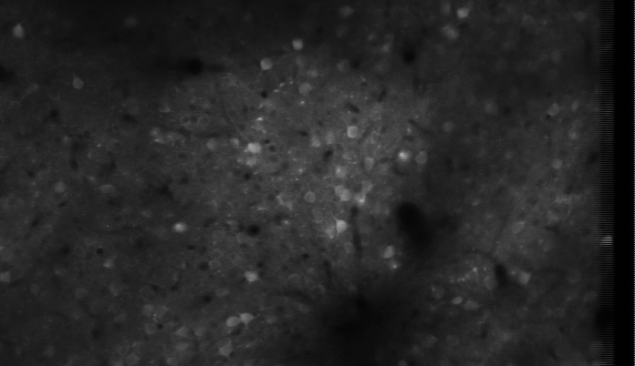 Applying non-rigid transformation matrix on another session · Issue ...