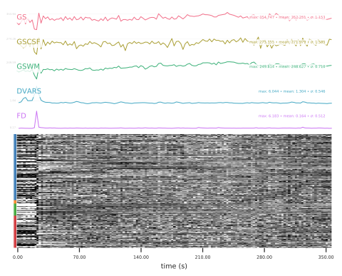 Carpet plots issue · Issue #1773 · nipreps/fmriprep · GitHub