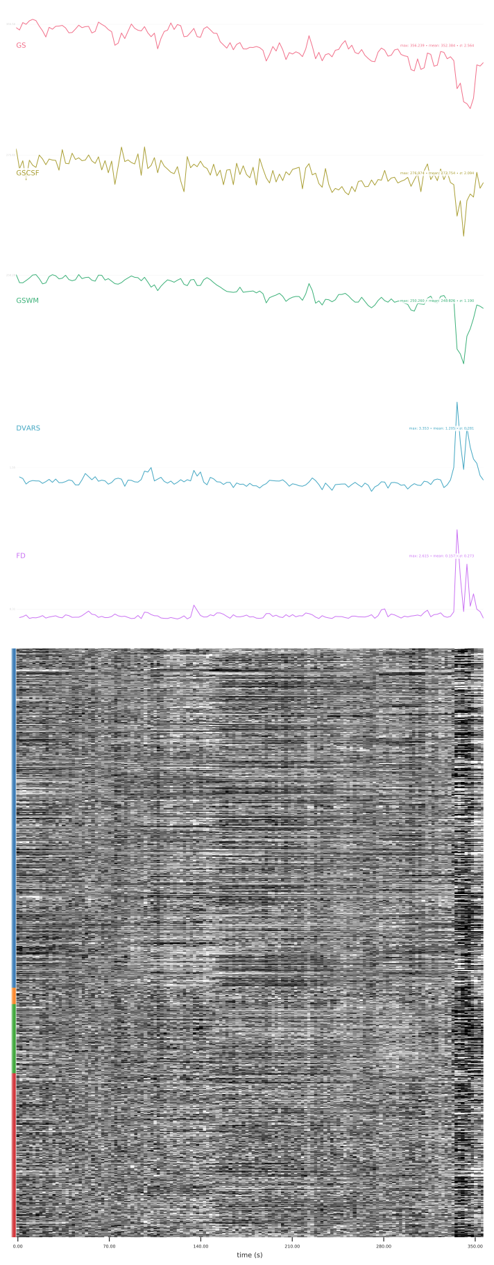 Carpet plots issue · Issue #1773 · nipreps/fmriprep · GitHub