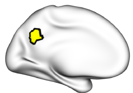 Show Glasser360 parcellation · Issue #48 · mandymejia/ciftiTools · GitHub