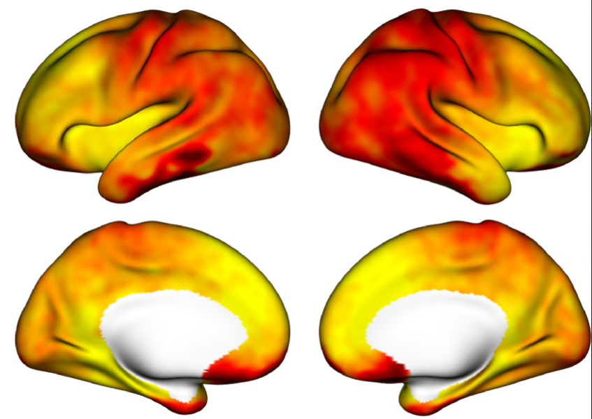 Show Glasser360 parcellation · Issue #48 · mandymejia/ciftiTools · GitHub