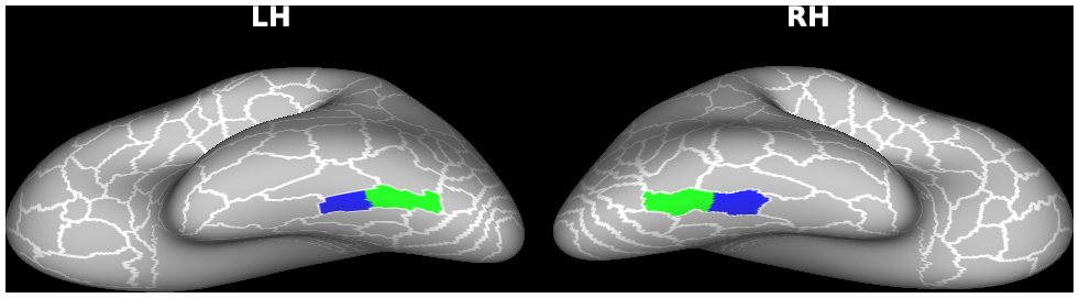 Show Glasser360 parcellation · Issue #48 · mandymejia/ciftiTools · GitHub