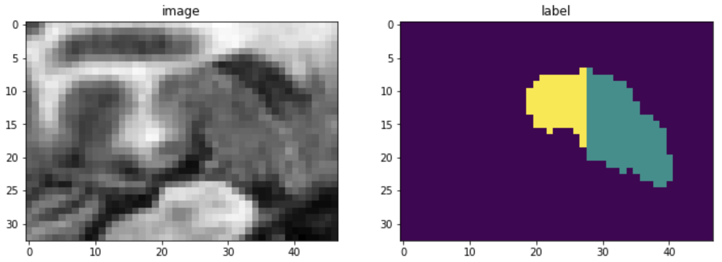 LoadImage Fails to Load Certain JPEGs · Issue #1007 · Project-MONAI ...