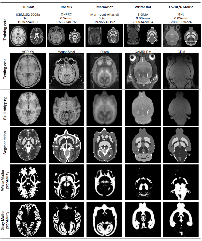 GitHub - frankyeh/UNet-Studio: U-Net Studio