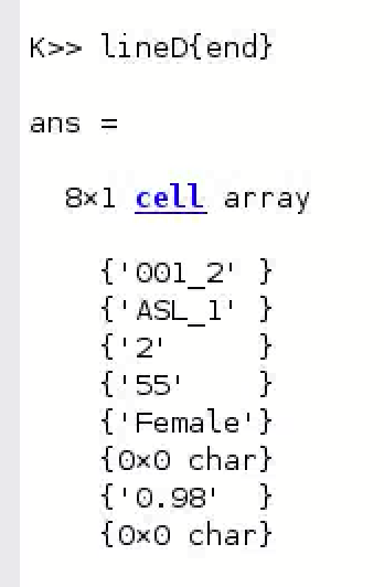 spm_load · Issue #1140 · ExploreASL/ExploreASL · GitHub