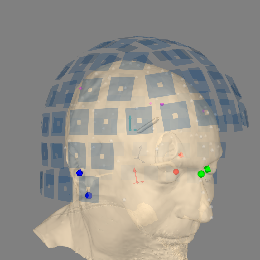 There are some bugs in the display results of the (mne.viz.plot ...