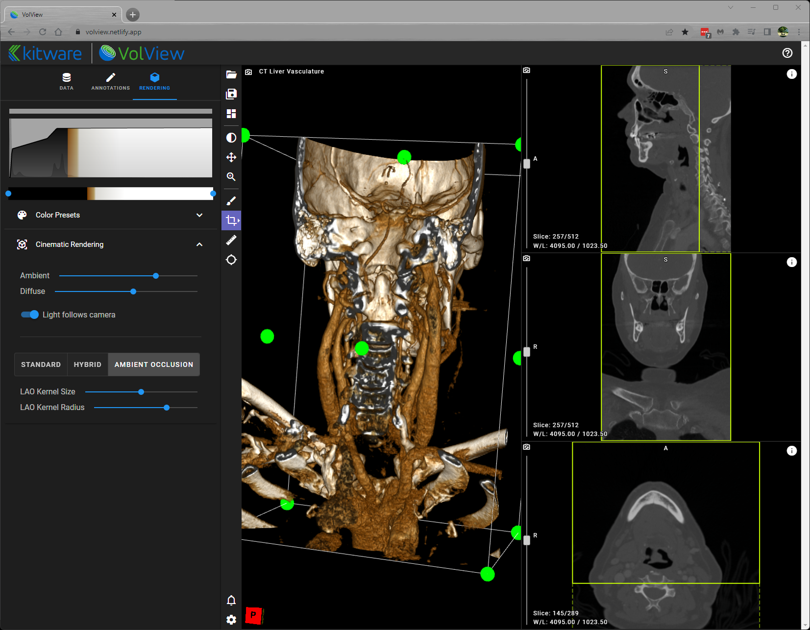 Cutting into objects causes them to have a dark appearance · Issue #245 · Kitware/VolView · GitHub