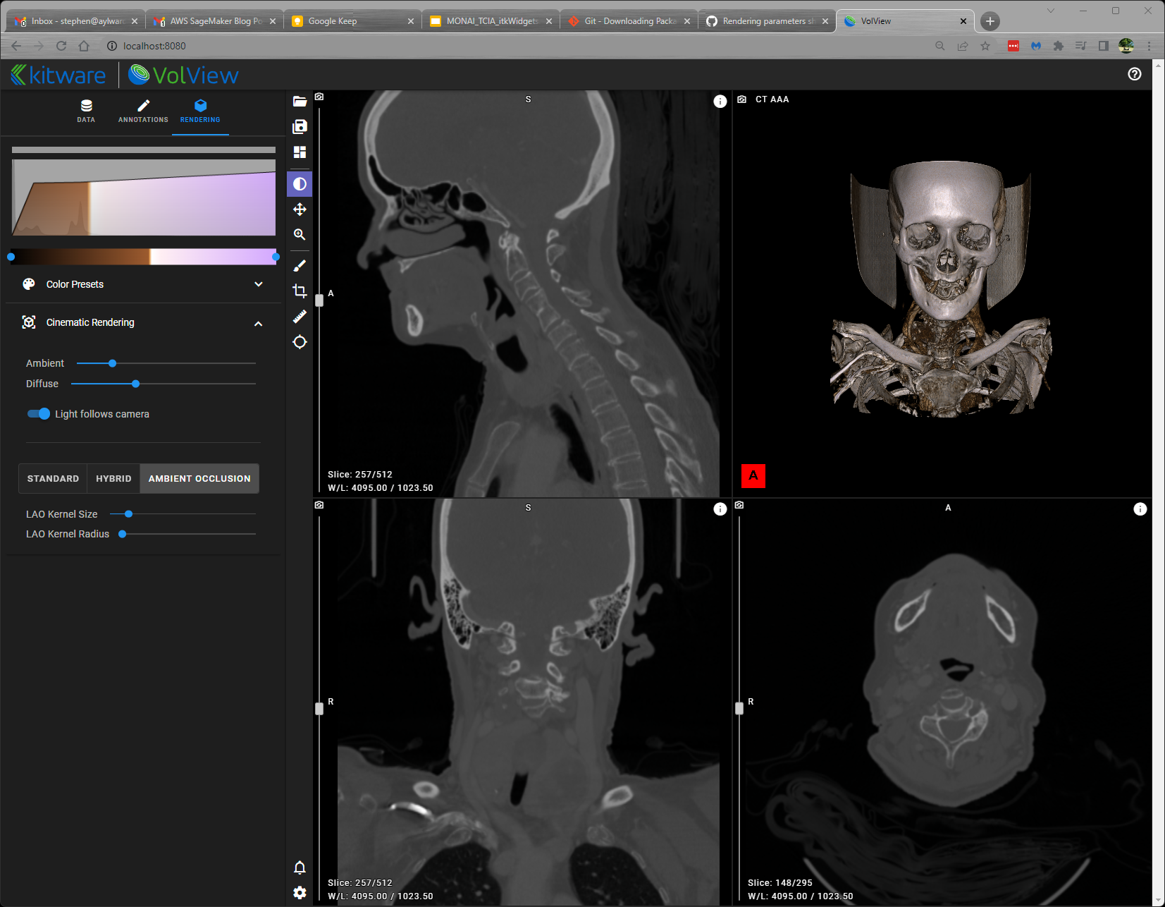 Rendering parameters should begin uncollapsed · Issue #246 · Kitware/VolView · GitHub