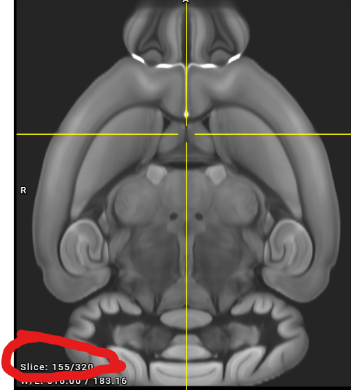 Physical position should be displayed as corner annotation when using ...